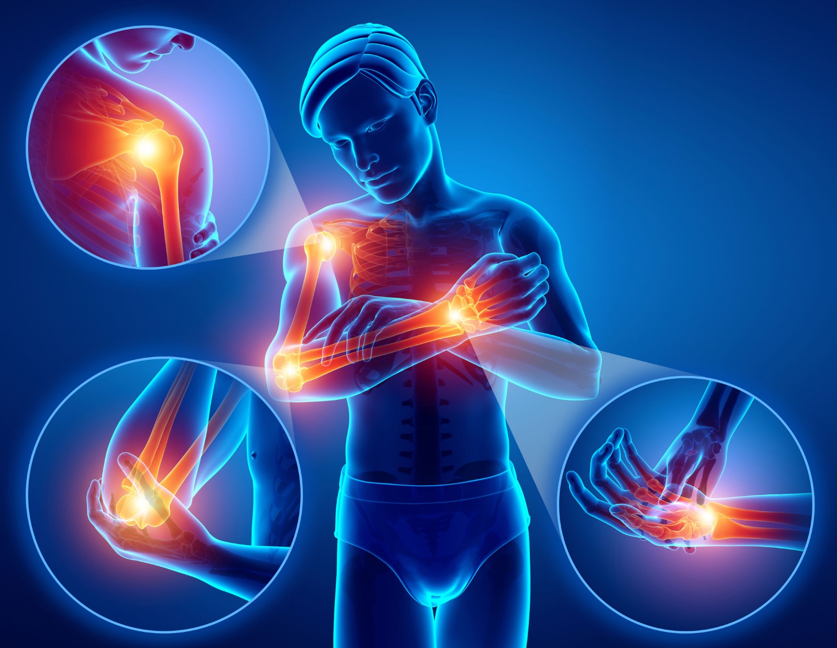 Carpal tunnel syndrome | Upper Extremity Entrapment Neuropathies | CTS